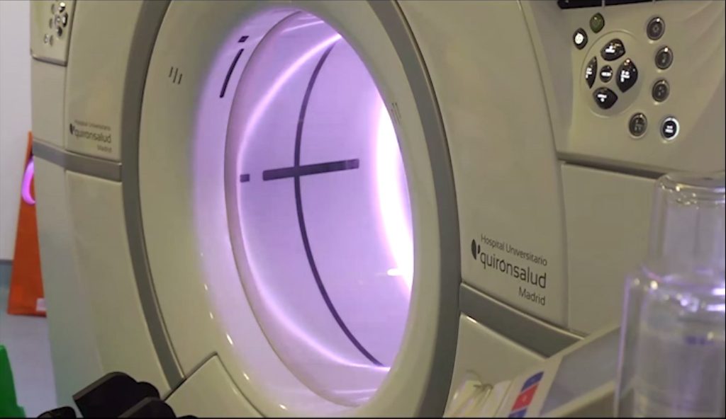Angio-TAC coronario (Video TAC) - CardioQuirón - Servicio de ...